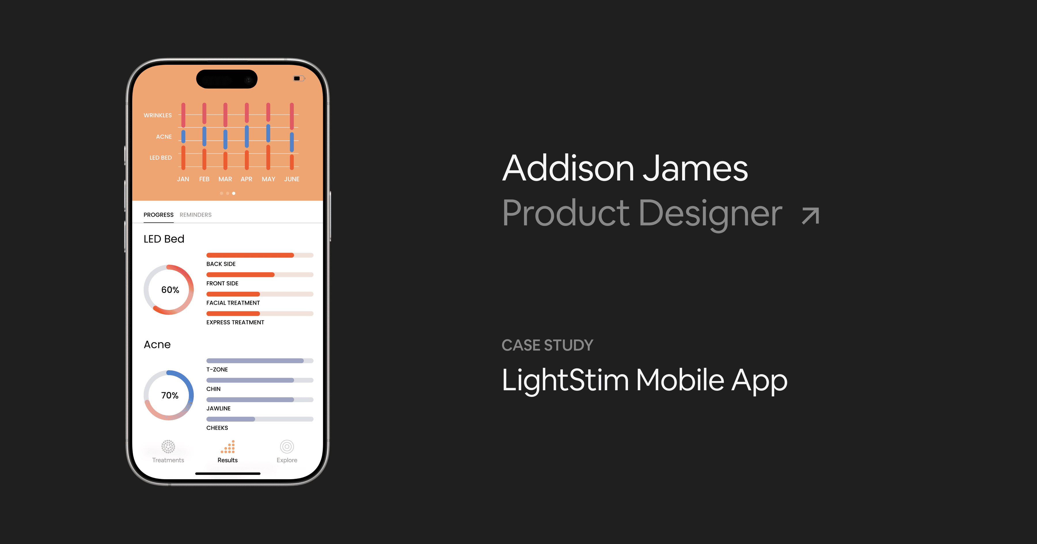 LightStim Case Study - Addison James