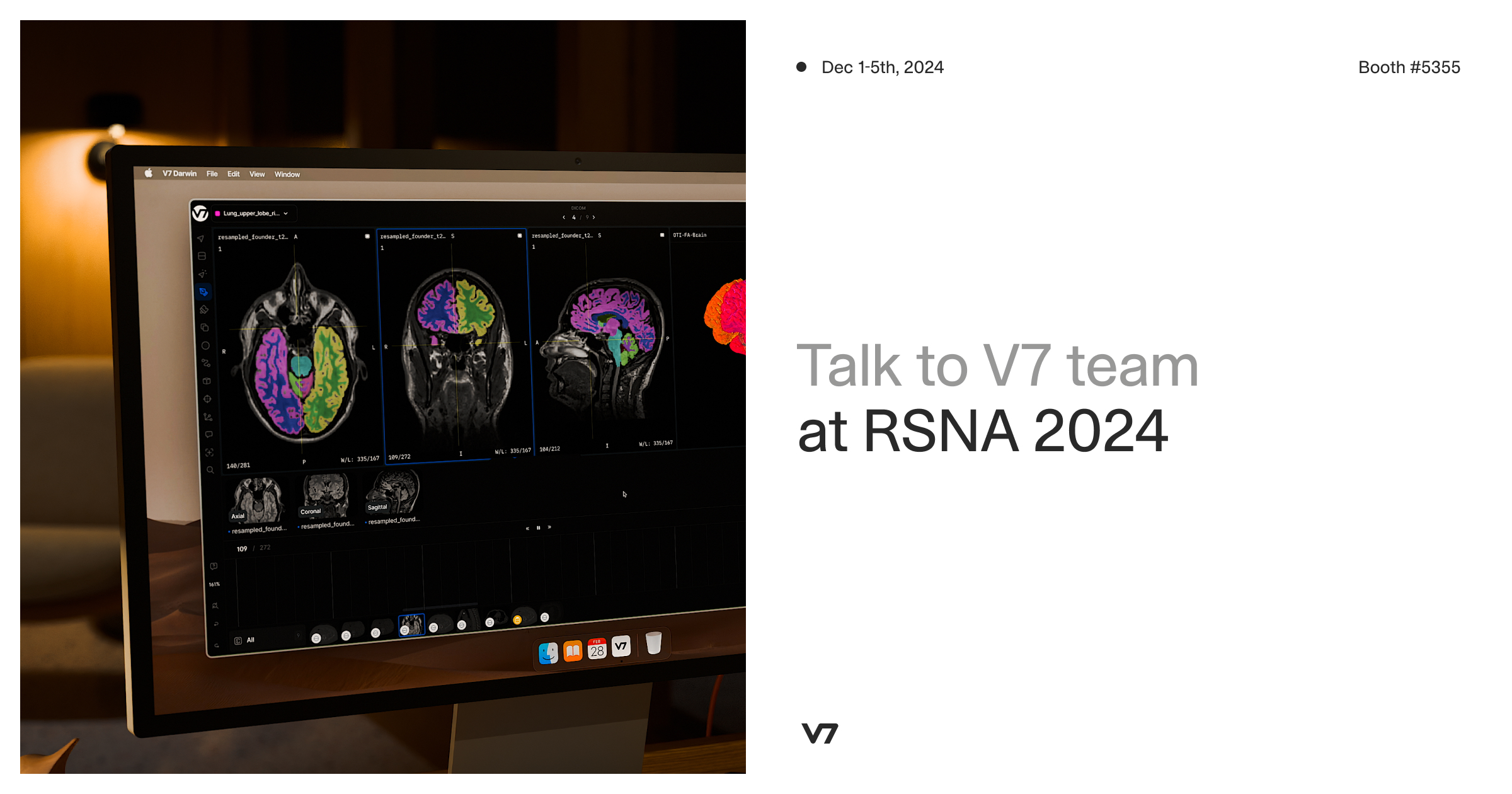 Visit V7 at RSNA 2024