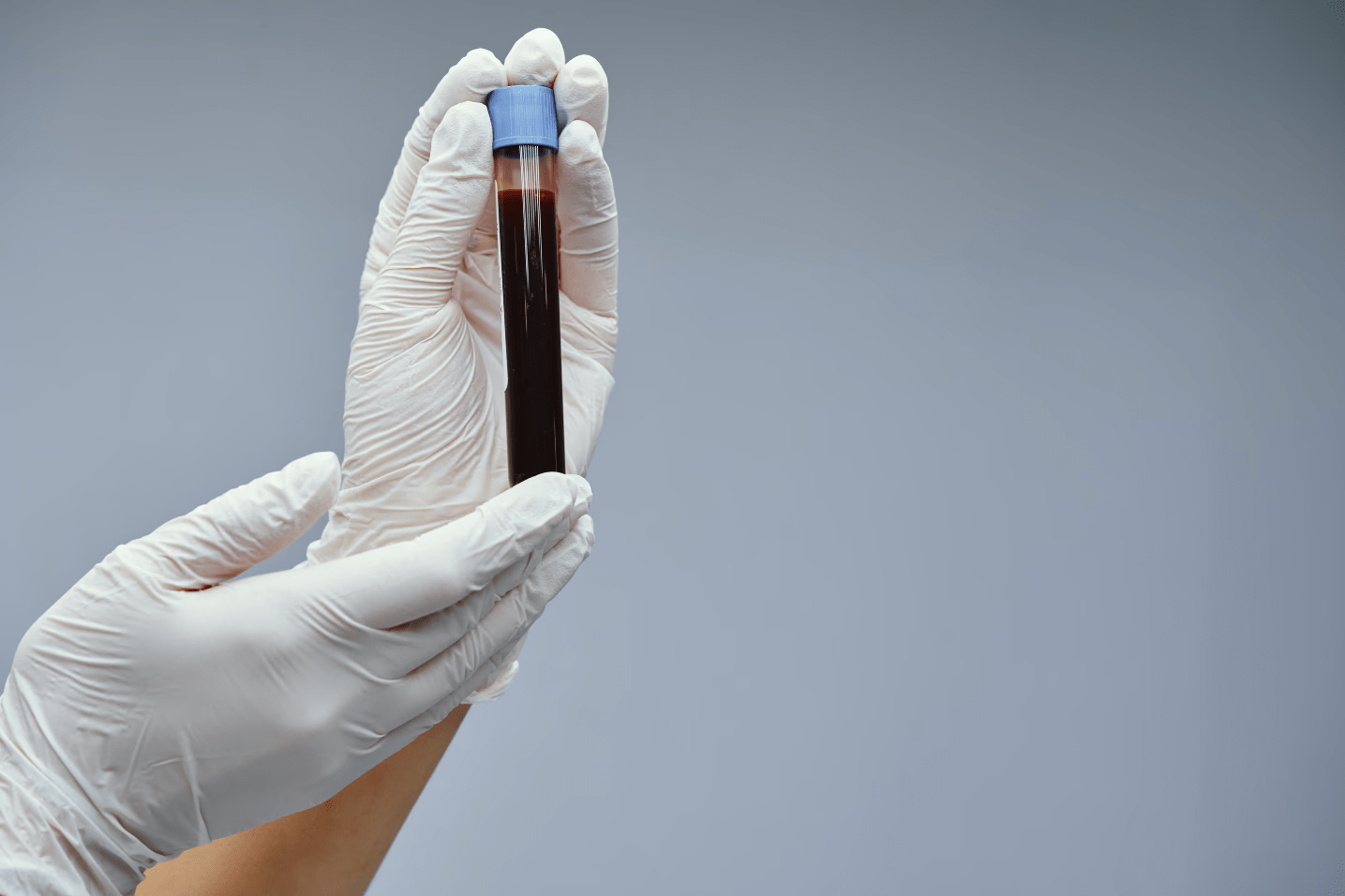 Blood Testing - Neo Medical
