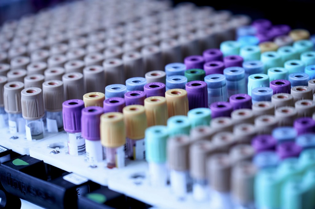 Peter Attia’s recommended blood tests: OGTT, ApoB test, and more | Nucleus