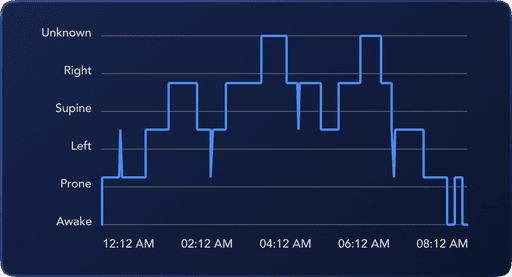 Neurobit Research Blog | Hypnograms: How To Read A Hypnogram