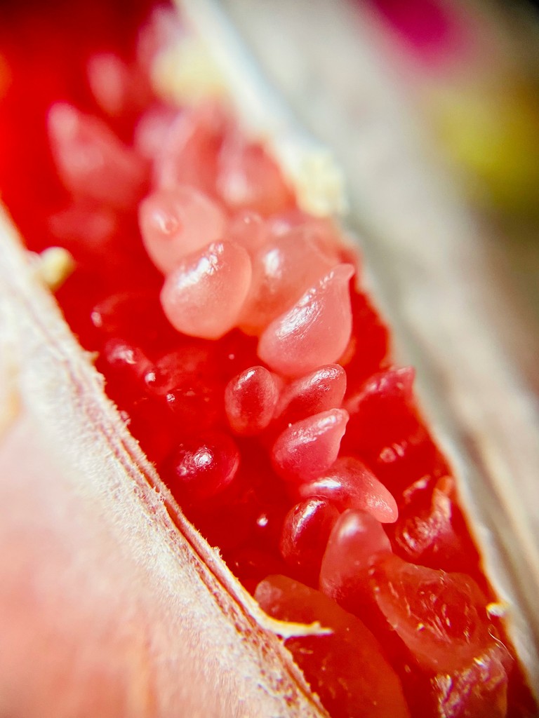 What is Thrombosis? - Vasculearn Network (VLN)