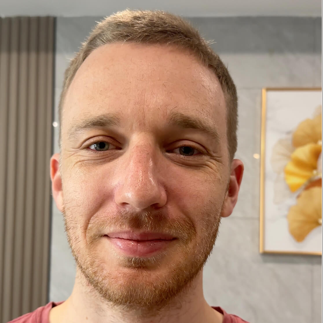 ClipEase - Smart Hair Clipper