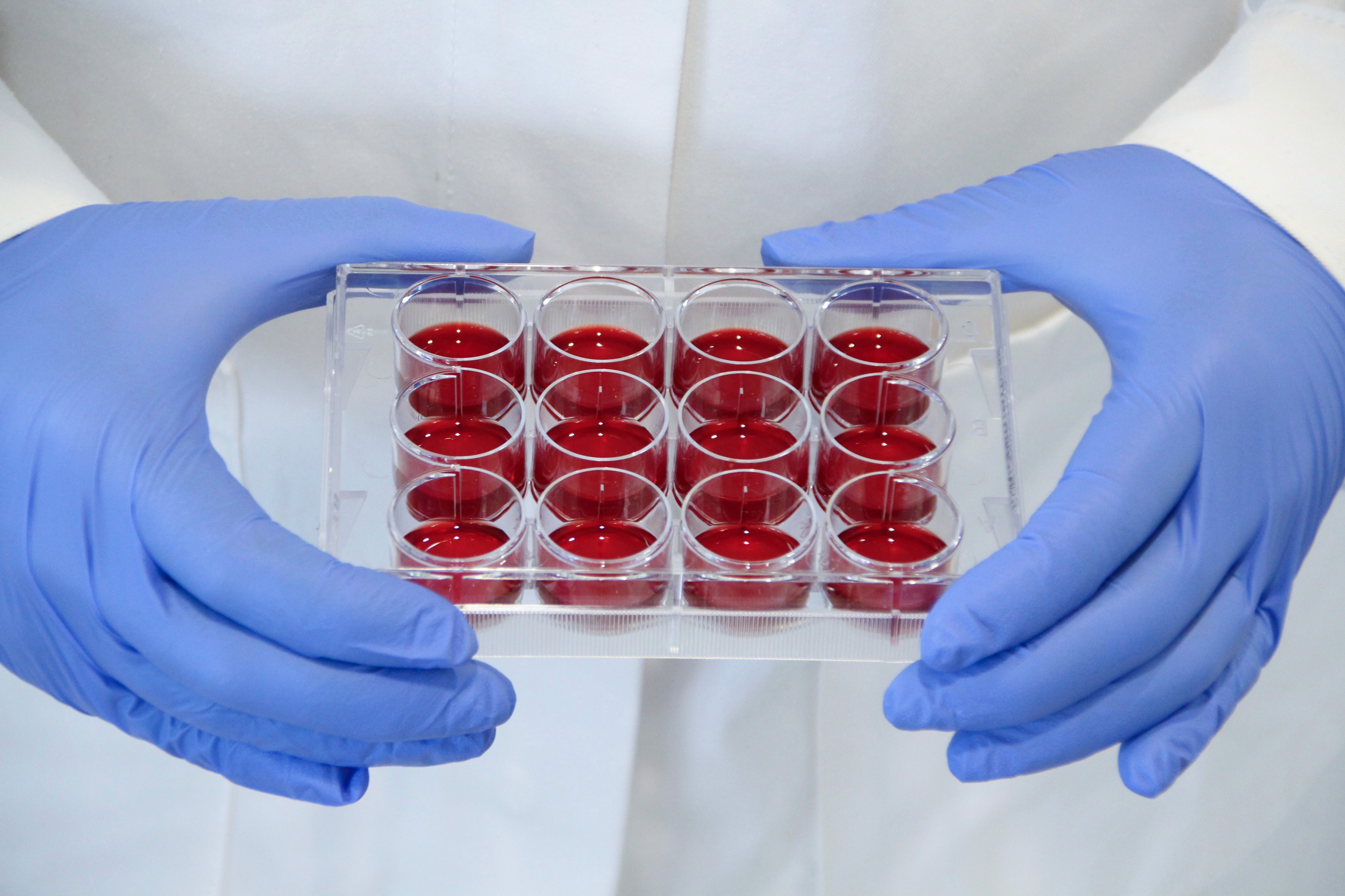 Pre Diagnostics - The Aria Project