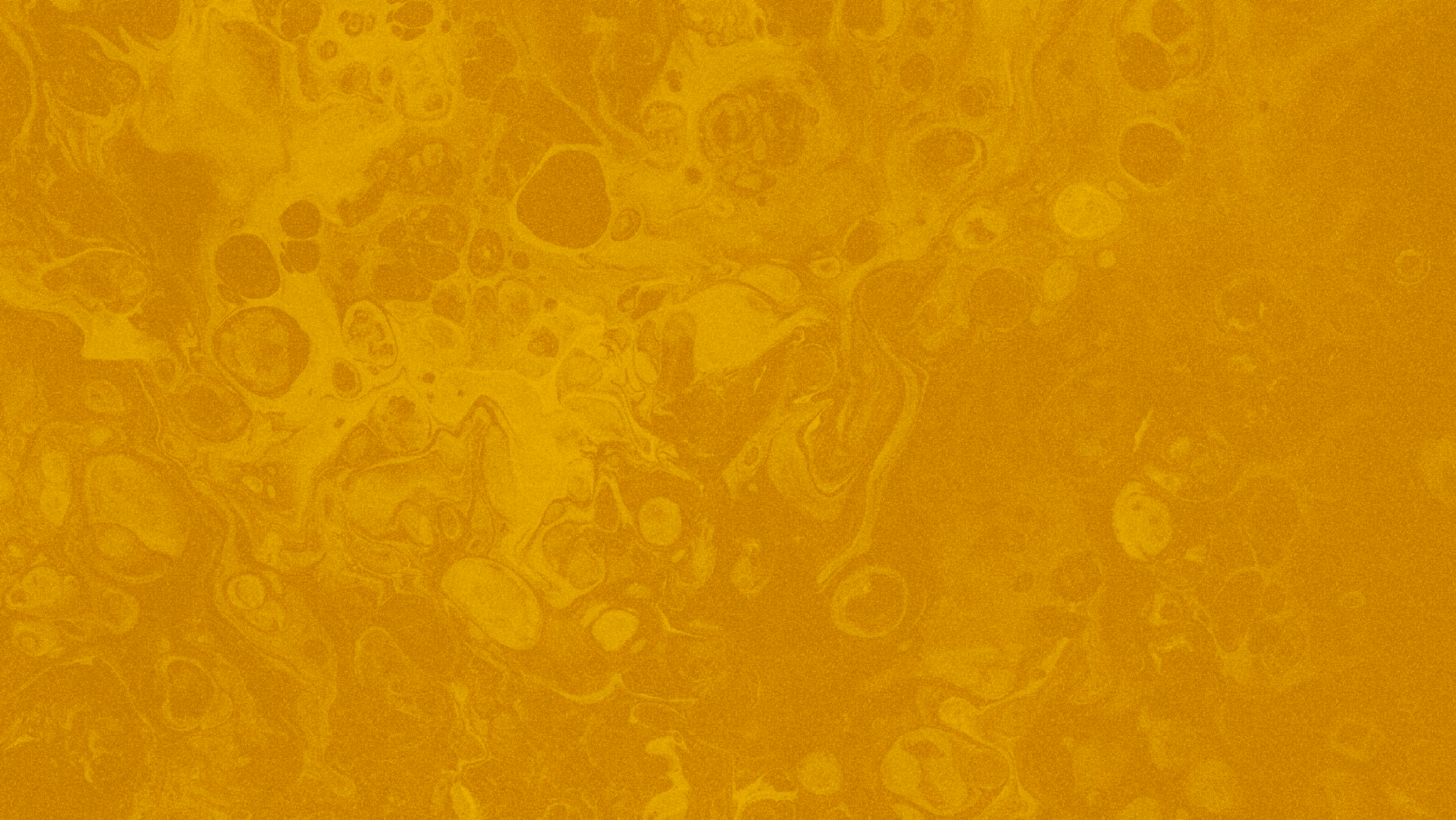 Intravascular Lithotripsy (IVL) Safety | FastWave Medical