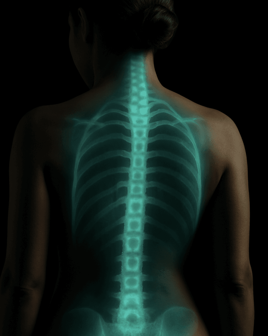 3D Spine Imaging & Remote Monitoring | Momentum Health