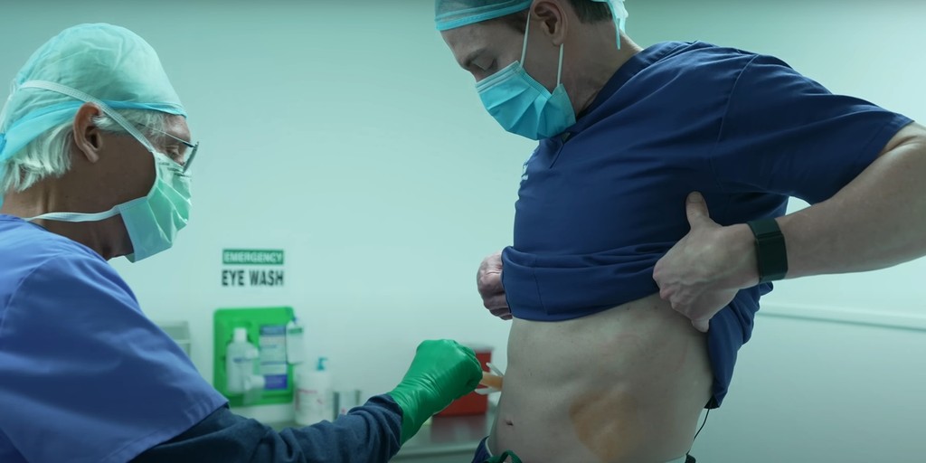 Bryan Johnson’s gene therapy: What you need to know | Nucleus