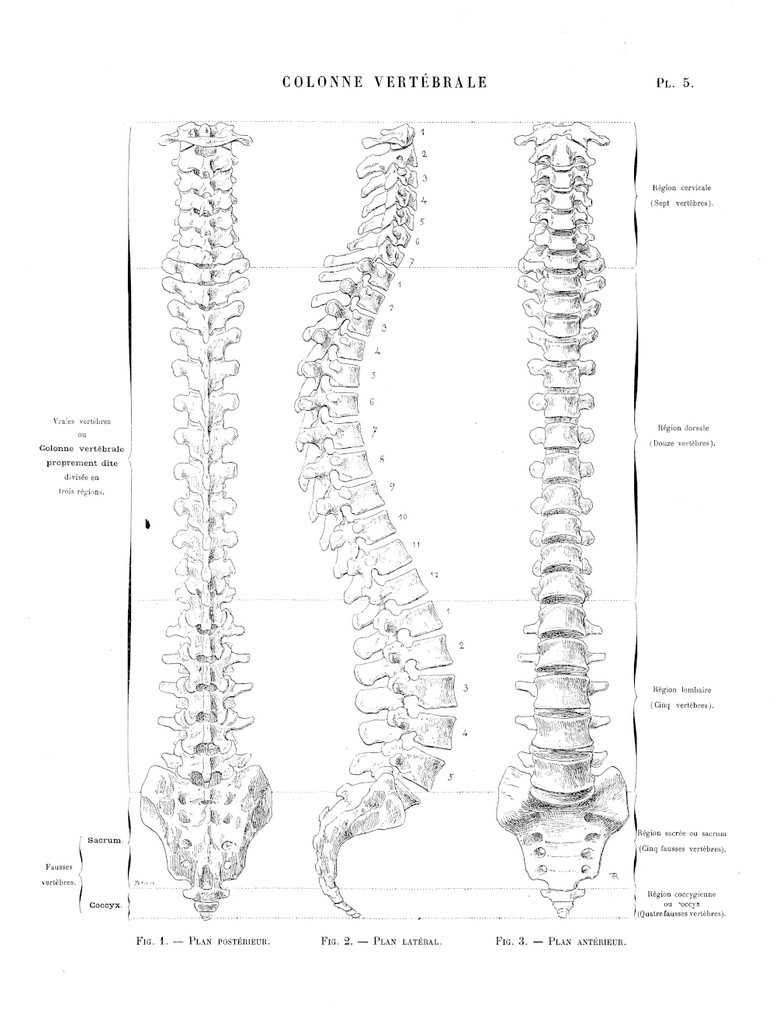 Lumbar Interbody Fusion (ALIF, OLIF, LLIF, TLIF) | Auckland ...