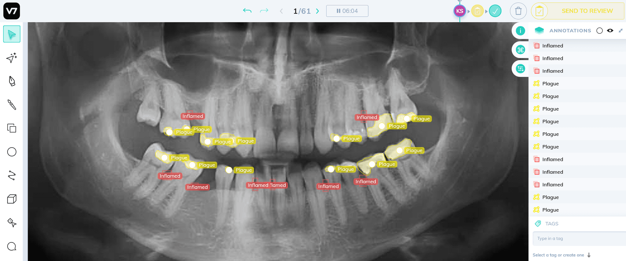 6 Innovative Artificial Intelligence Applications in Dentistry