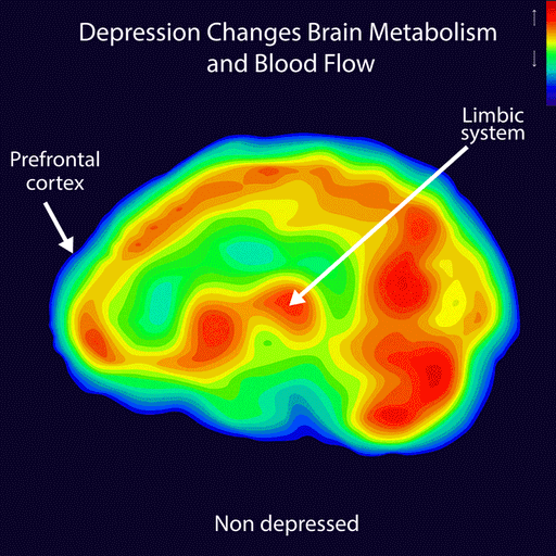What Is TMS - Bluebell Health