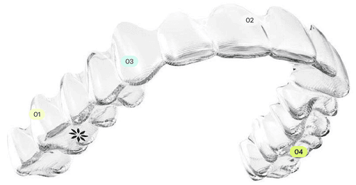 Invisalign Treatment Dubai: Invisible Aligners, Clear Braces