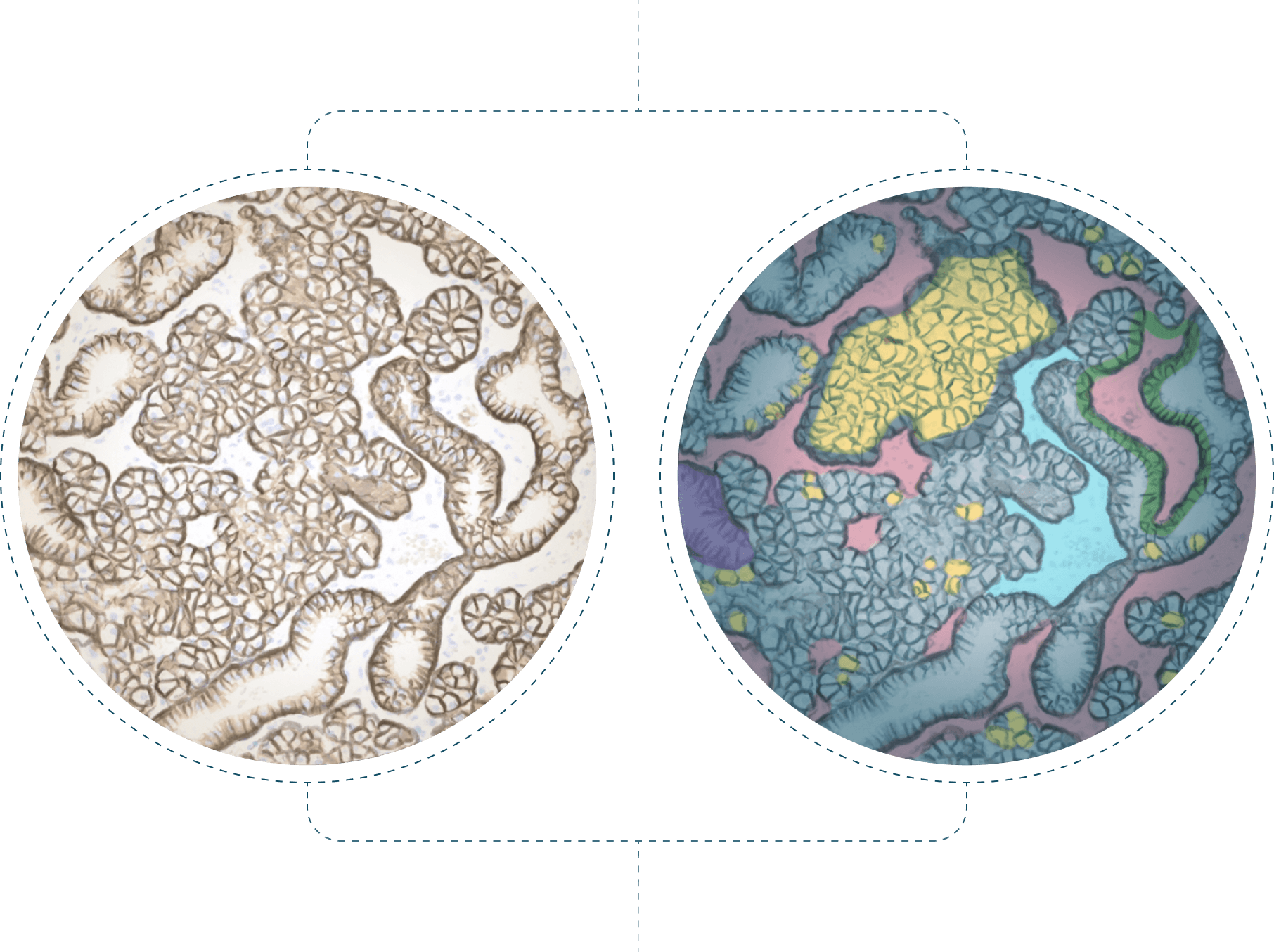 OmicVision - Pioneering spatial proteomics to transform precision medicine