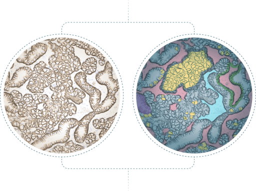 OmicVision - Pioneering spatial proteomics to transform precision medicine