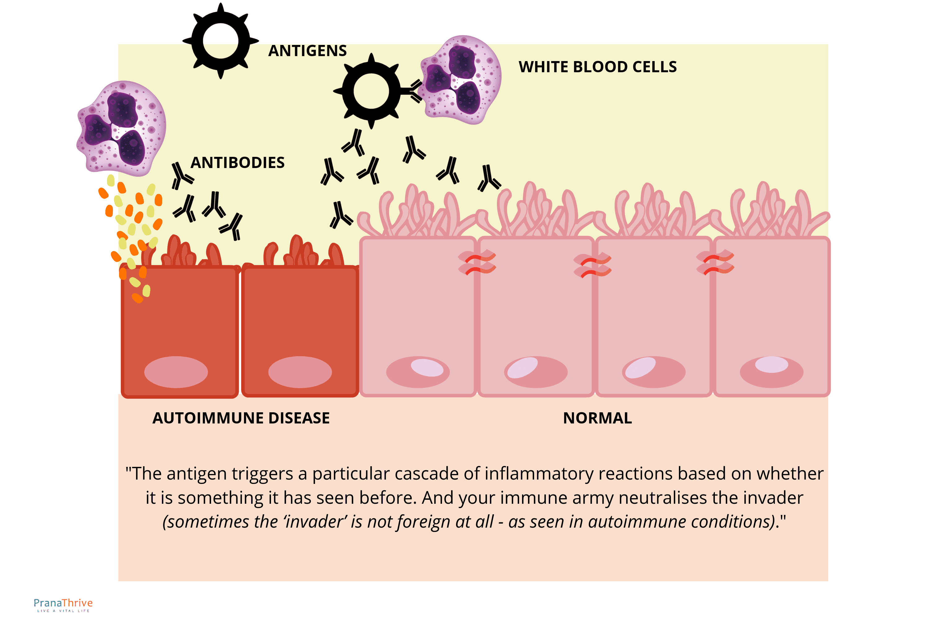 The Gut-Immune System Connection | Prana Thrive - Prana Thrive ...