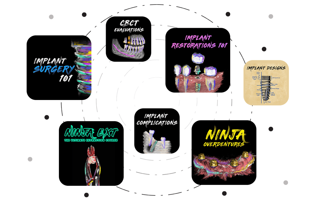 The Implant Track - Implant Ninja