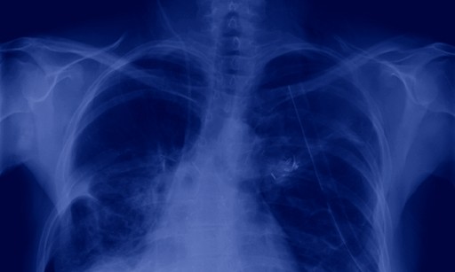 Cross-center validation of deep learning model for musculoskeletal ...