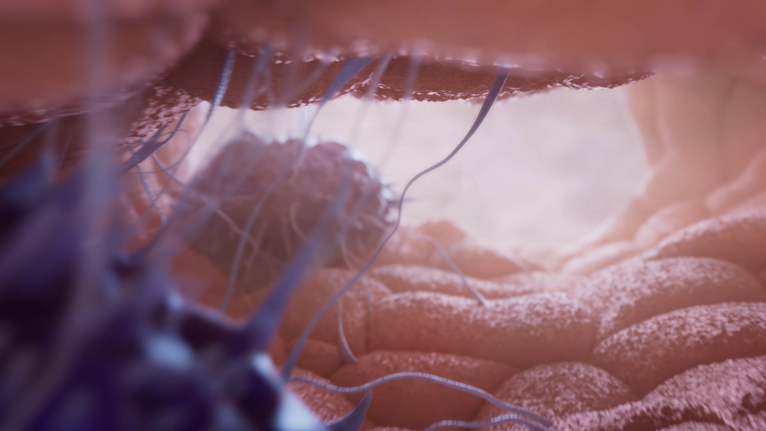 MoA Animation RAS(ON) Inhibitors Case Study | Visual Science