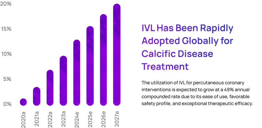 Intravascular Lithotripsy (IVL) Catheters | FastWave Medical