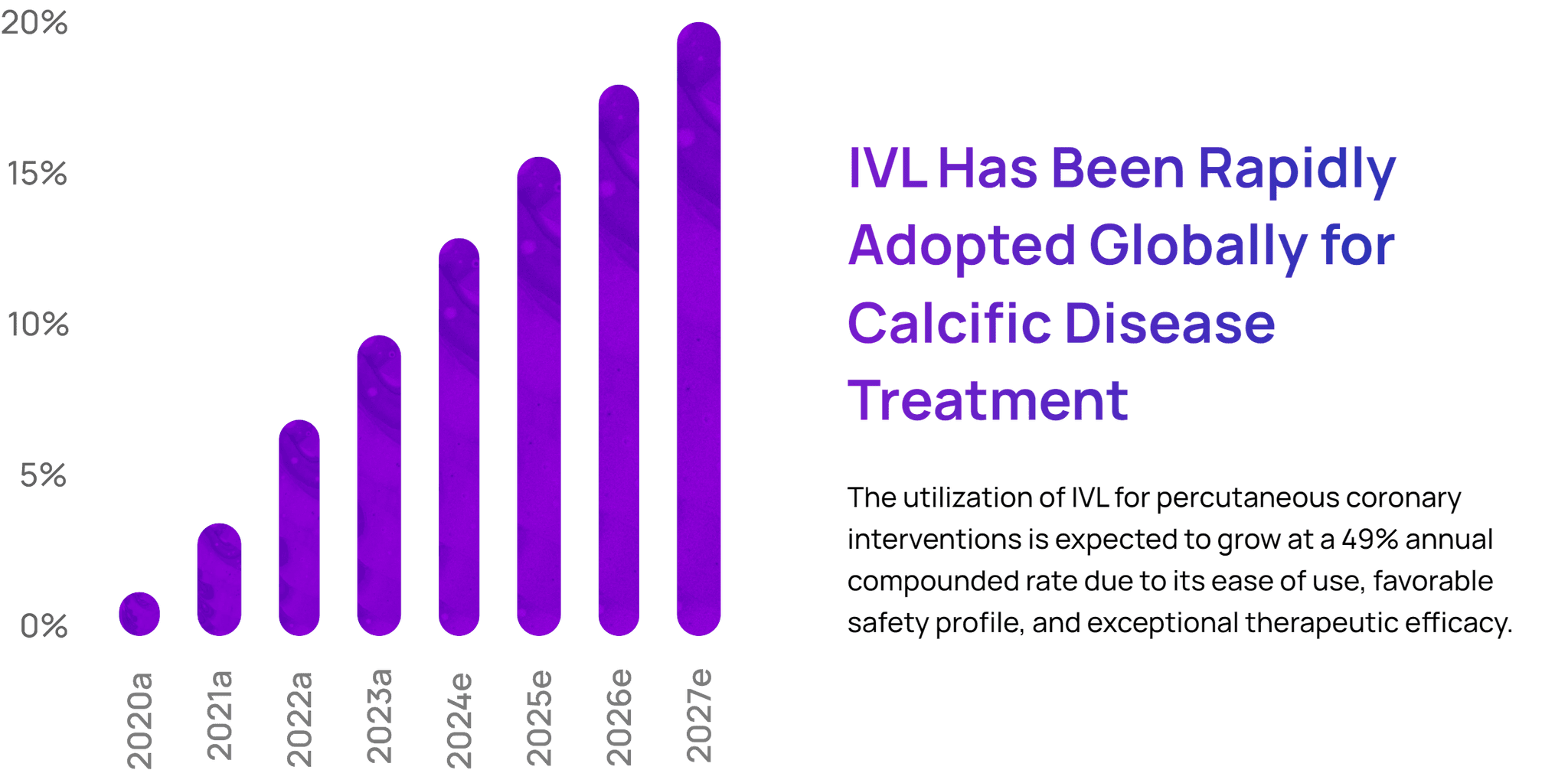 Intravascular Lithotripsy (IVL) Catheters | FastWave Medical