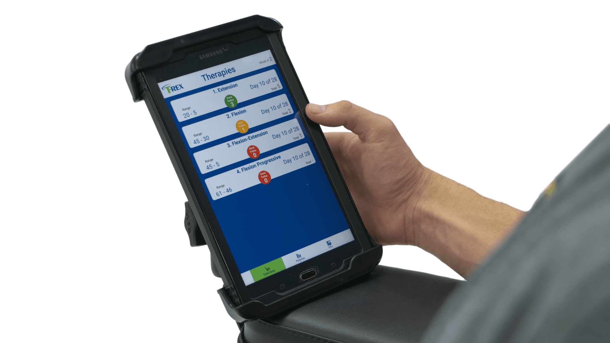 T-REX SmartRehab Device – High-Intensity Motion Recovery