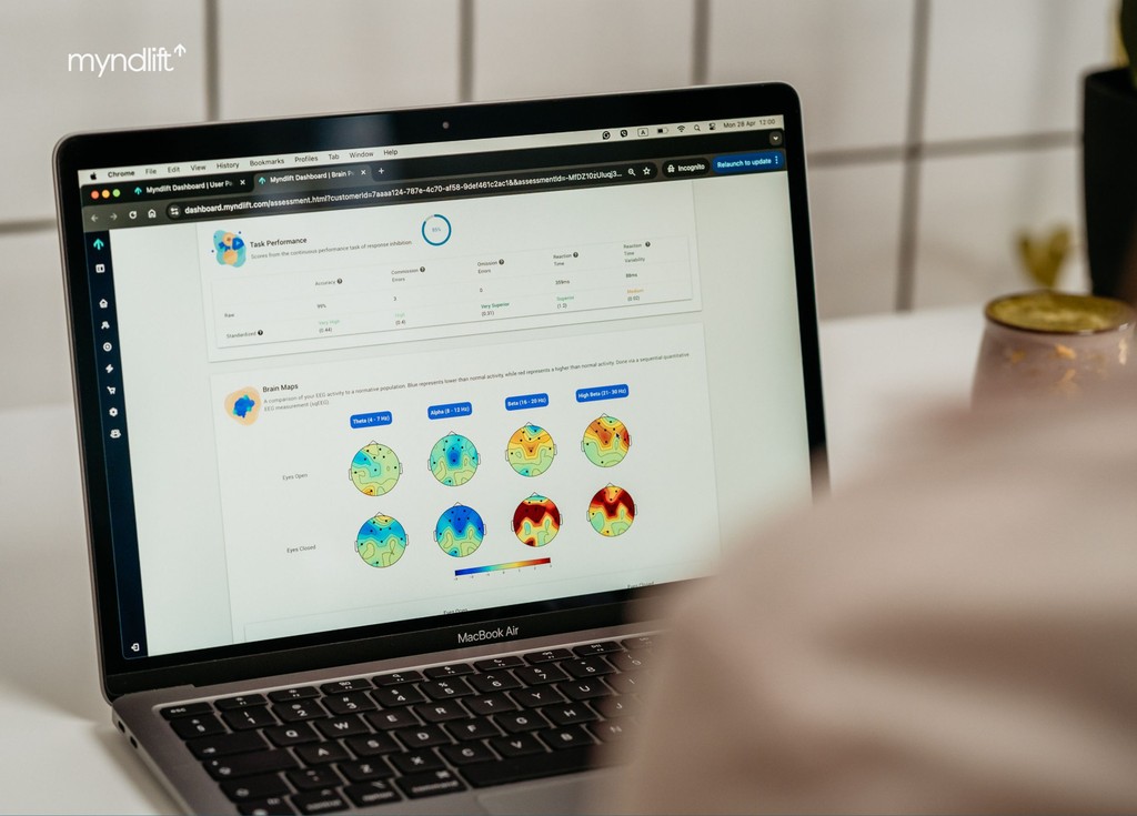 How to Read a qEEG Brain Map: A Practical Guide