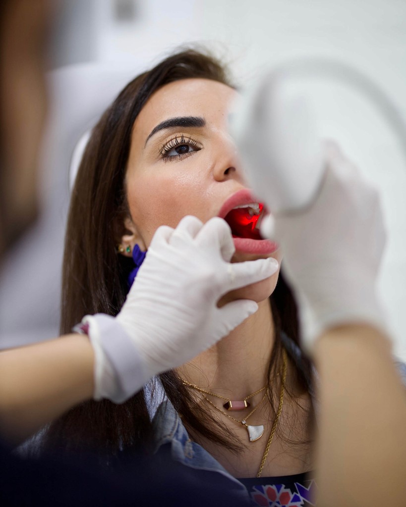 Teeth Retainers: Types, Uses, and Benefits