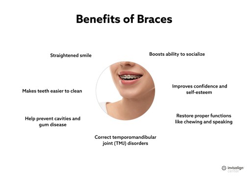 Braces: Types, How They Work, Care, Cost, and Results