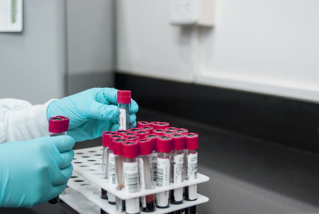 Prenatal genetic testing pros and cons: What expectant parents should ...