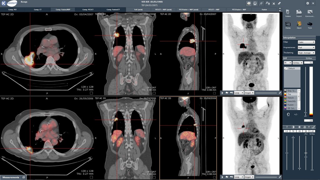 What is PET Imaging and How is it Used in Clinical Trials? | Banook