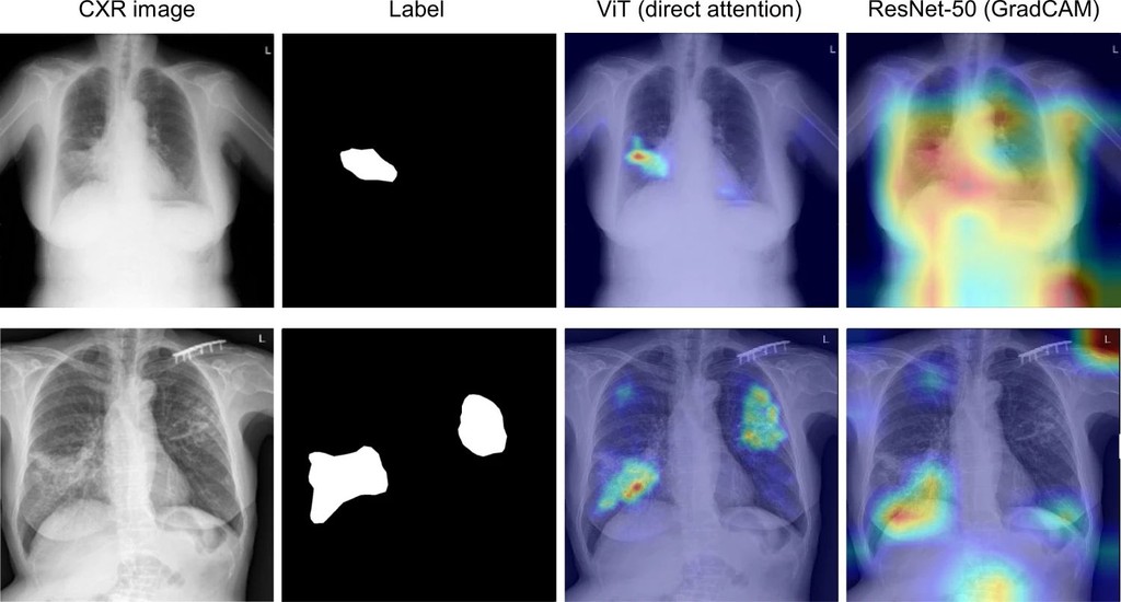 Transformer architecture: redefining machine learning across NLP and beyond