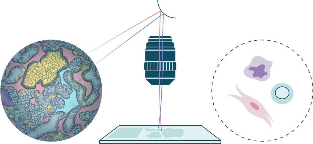 OmicVision - Pioneering spatial proteomics to transform precision medicine