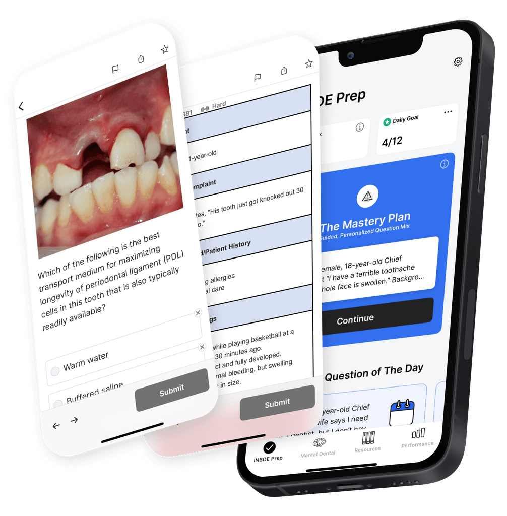 INBDE® Prep | Practice Questions & Mental Dental Videos - Pass Guarantee.