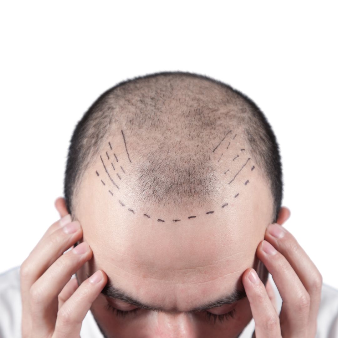 La clinique MORE - Solutions et Traitements Cheveux