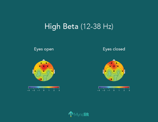 Everything You Need to Know About qEEG: A Map That Reveals Insights ...