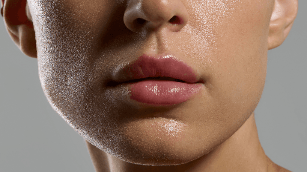 Marionette Lines Treatment Manchester | Mouth to Chin Lines Filler