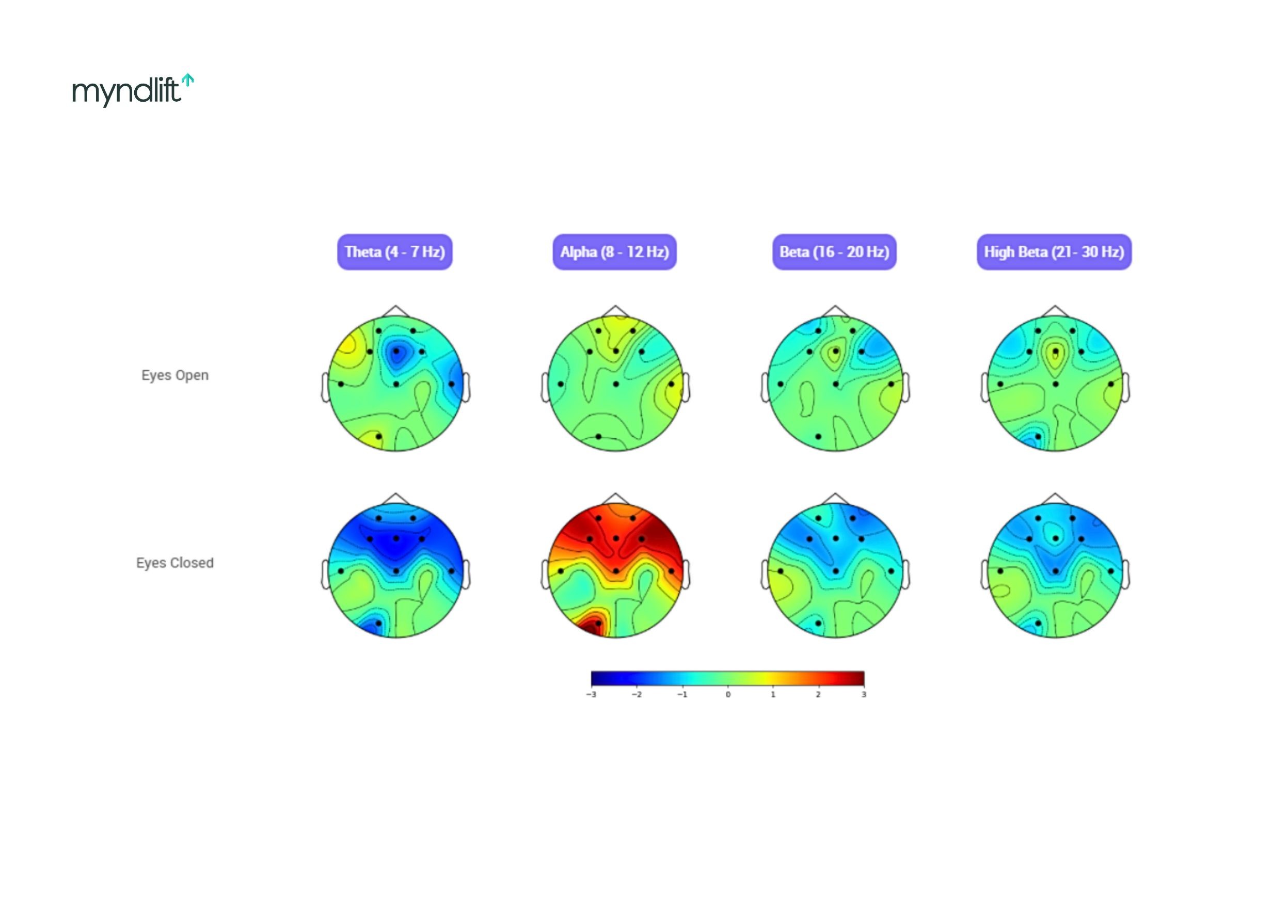 How to Read a qEEG Brain Map: A Practical Guide