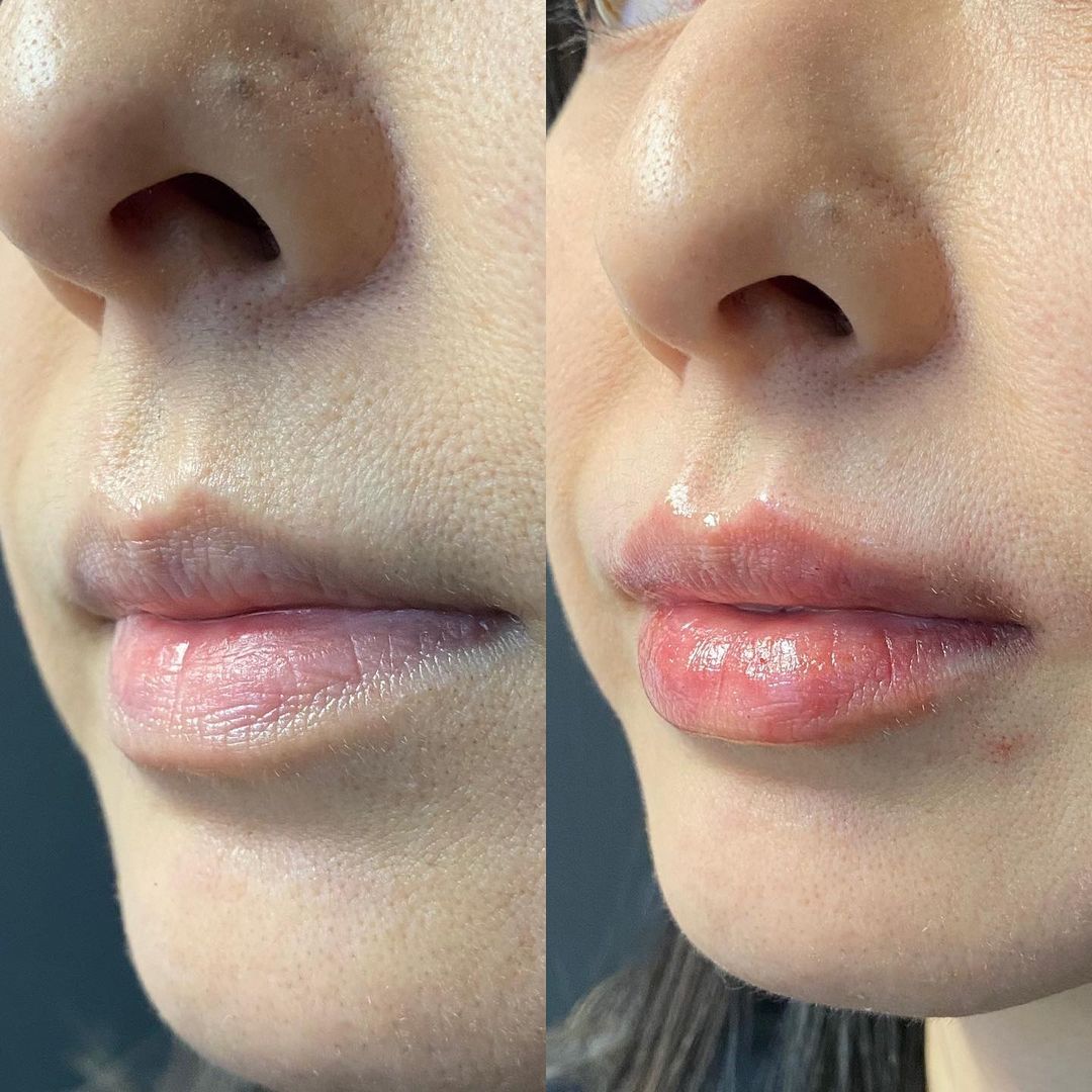 Linnell Dermatology and Aesthetic Clinic - Seattle WA