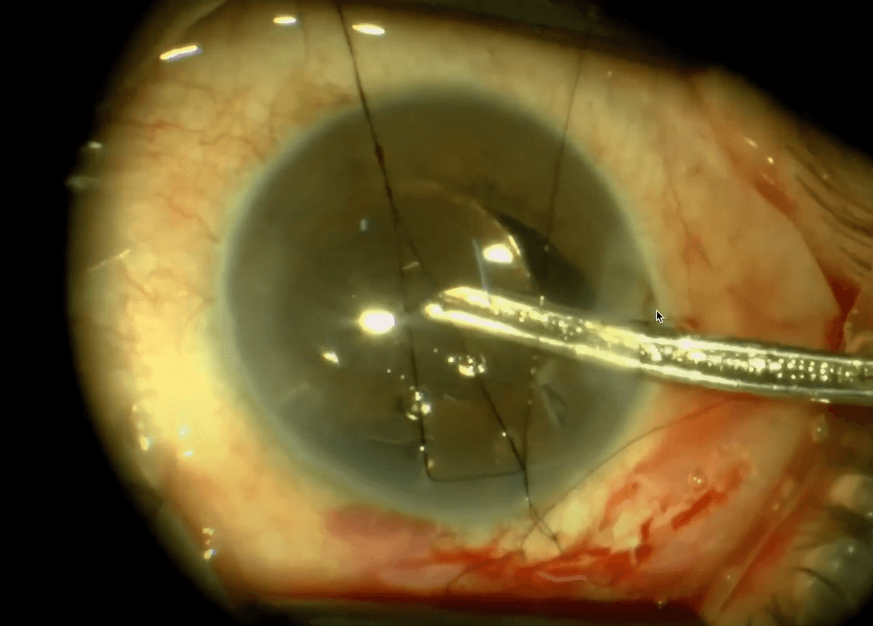 Kanaflix - Plataforma de ensino em saúde