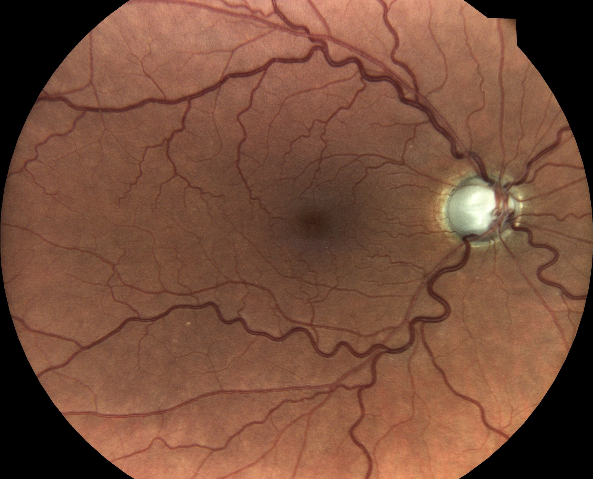 Ocumeda - Eye Check-Up