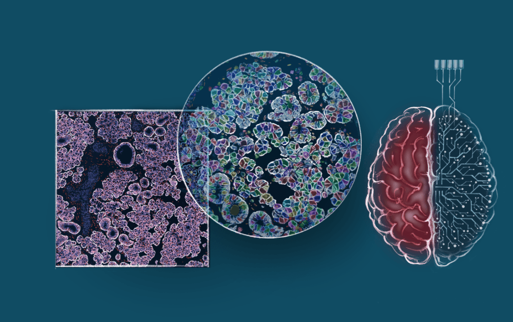 OmicVision - Pioneering spatial proteomics to transform precision medicine