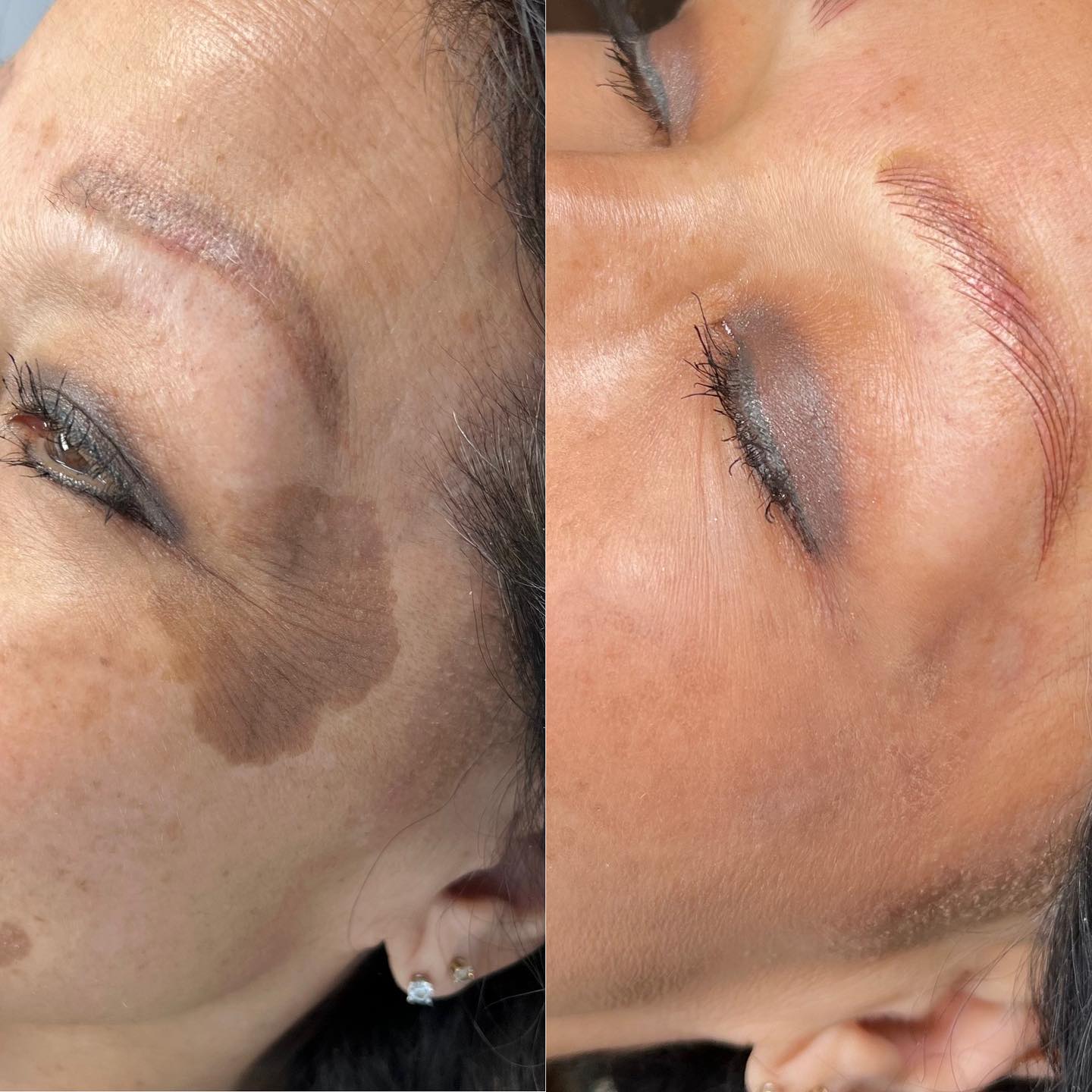 Linnell Dermatology and Aesthetic Clinic - Seattle WA