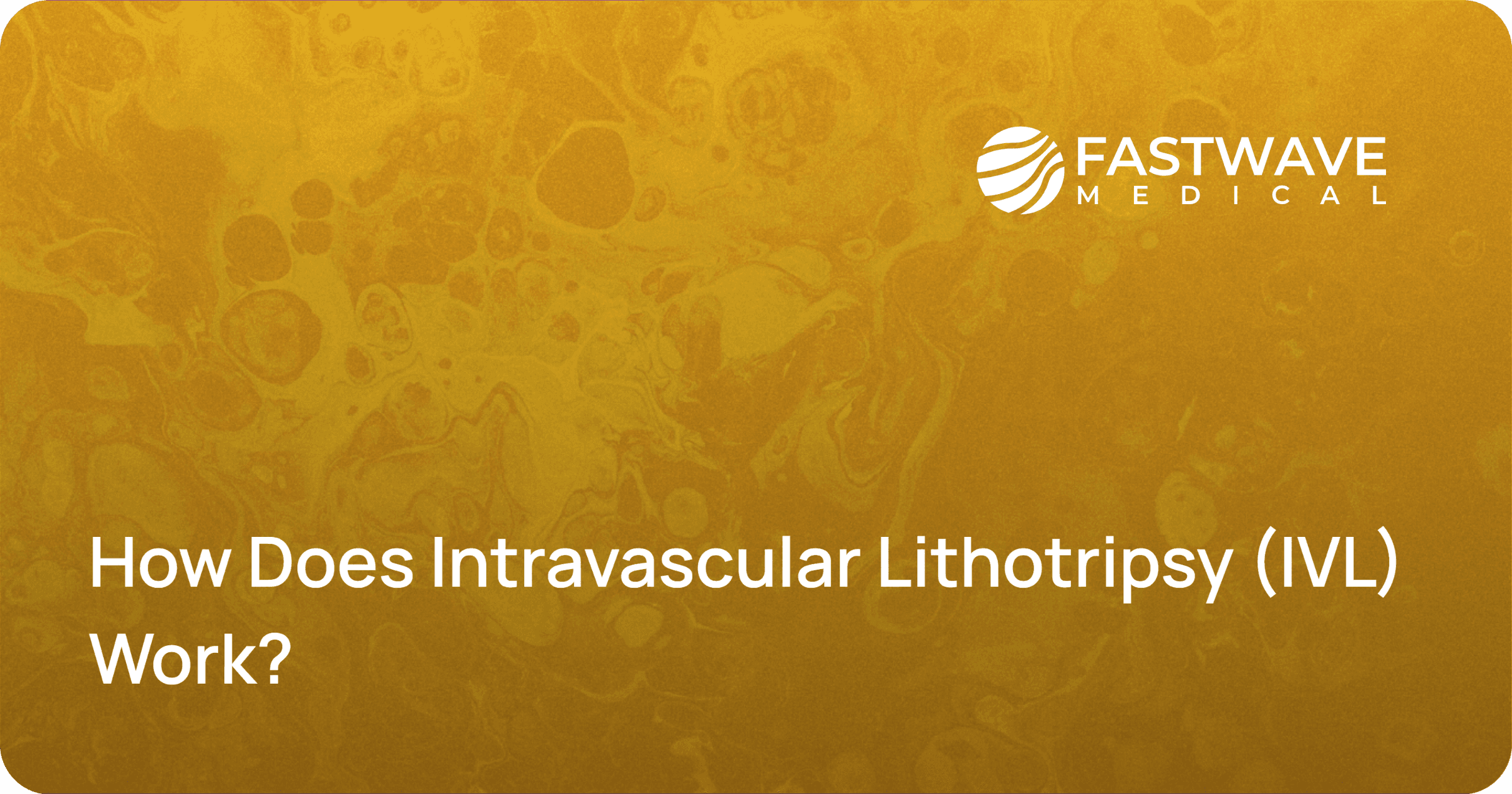 How Does Intravascular Lithotripsy (IVL) Work? | FastWave Medical