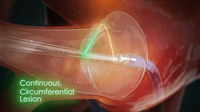 Heartlight X3 System