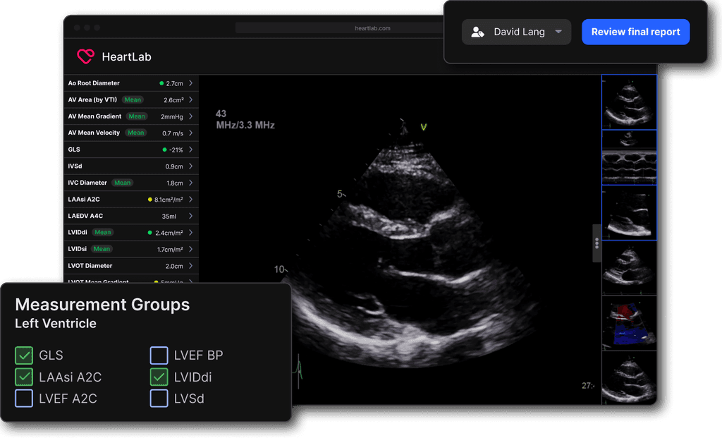 HeartLab | The Heart of Cardiac Imaging.