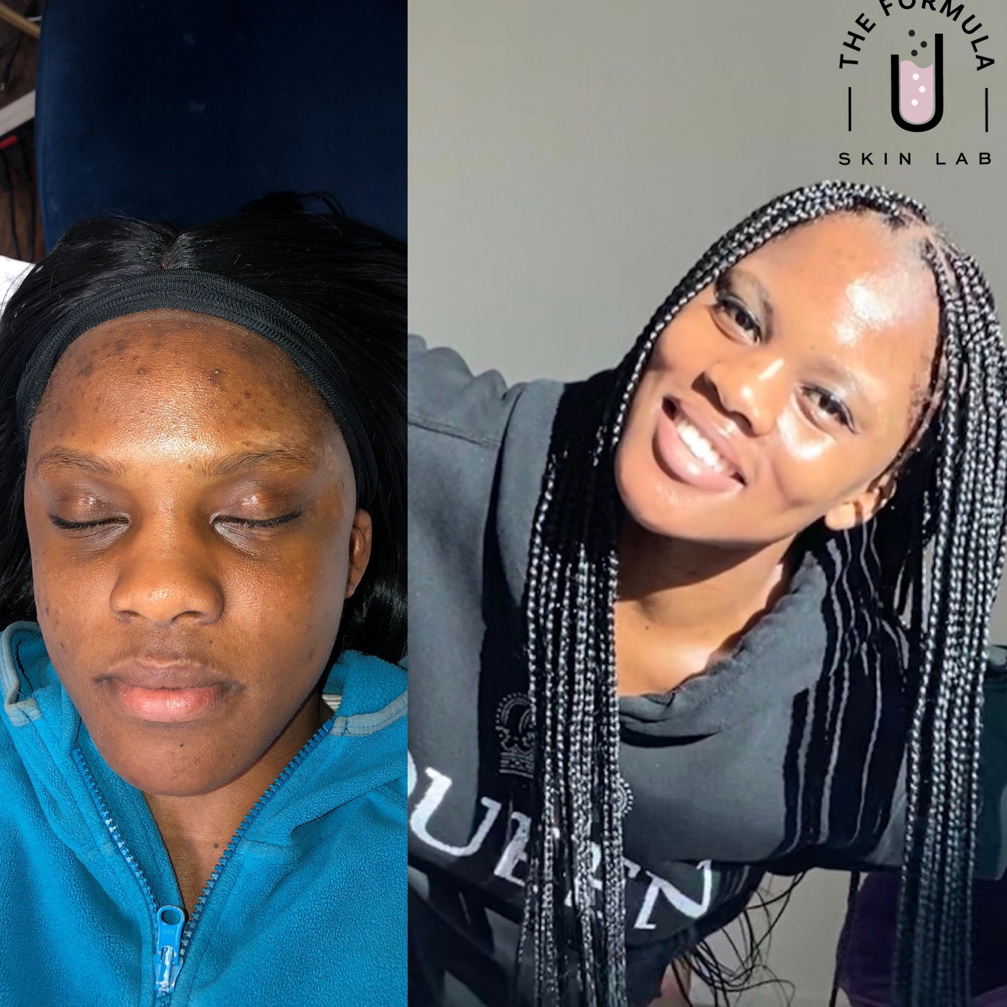 The Formula Skin Lab | Best Esthetician in San Diego