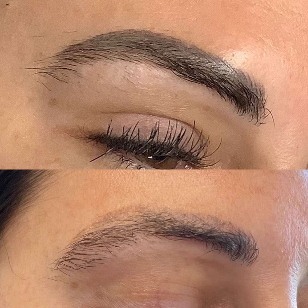 Linnell Dermatology and Aesthetic Clinic - Seattle WA