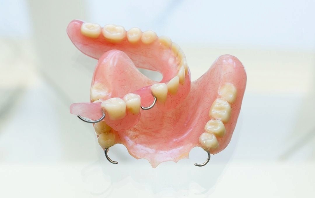 Midtown Dental Studio in Eglinton | Partial Dentures: What They Are ...