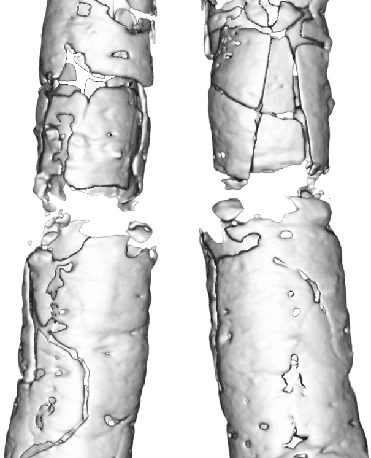 Novel IVL for Coronary Artery Disease | FastWave Medical