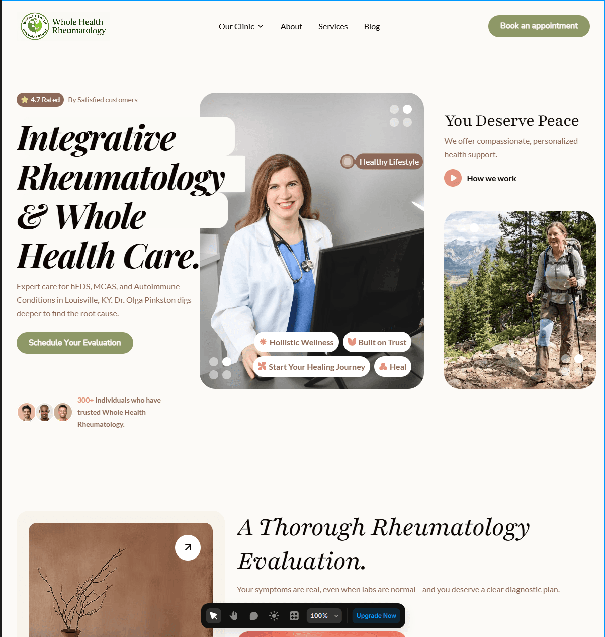 Lupus and evaluation for +ANA | Whole Health Rheumatology