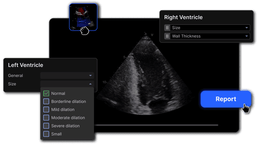 HeartLab | The Heart of Cardiac Imaging.